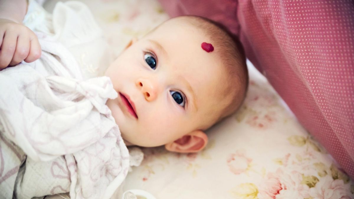 Hemangiomas: A Bright Red Birthmark That Appears At Birth.
