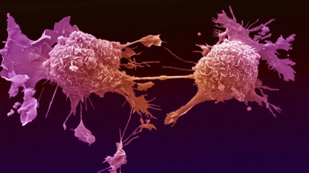 Scientists Discover Drugs That Can Probably Starve Cancer Cells ...