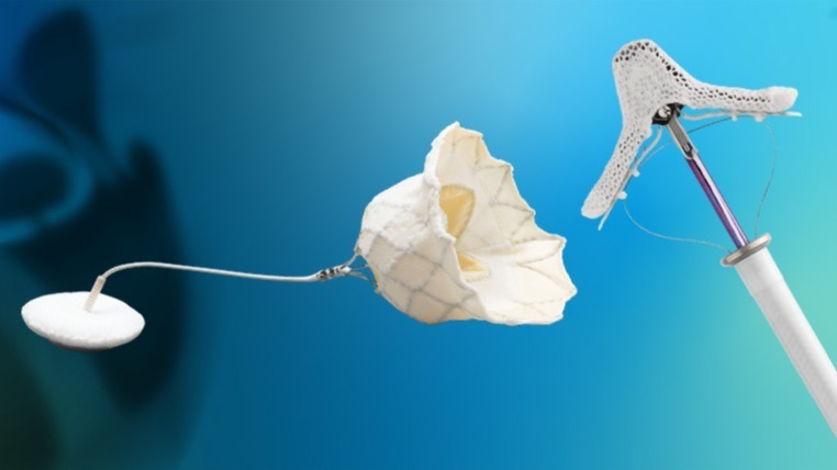 Abbott Strengthens Structural Coronary Heart Portfolio With New Clip ...